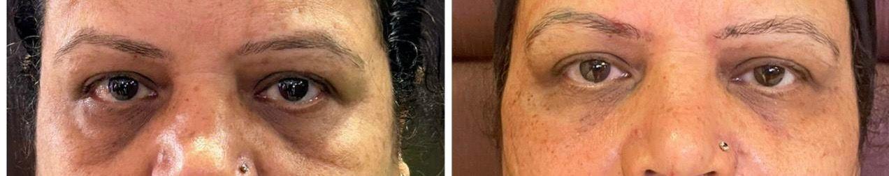 Advanced Skin Treatments by Dermatologist in Vasant Vihar
